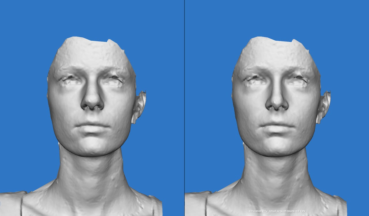 Online Consultation – Dr Raspaldo, Face and Neck surgeon