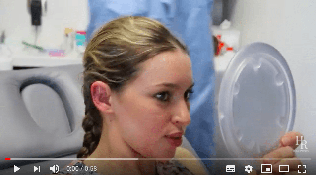 Earfold clips for protruding ears – Results (part. 4) – Dr Raspaldo ...